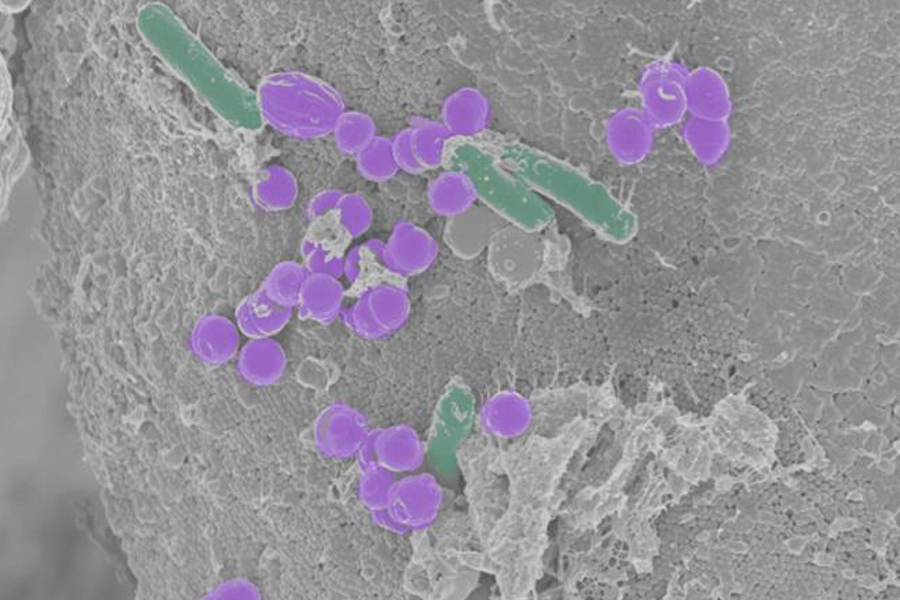 New microbiome tool: Gut bacteria cooperation vs. competition ...